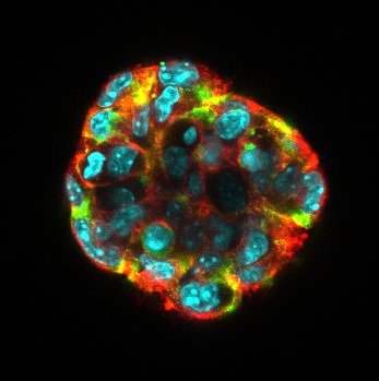 Research – Cell mechanics group, Biomechanics lab